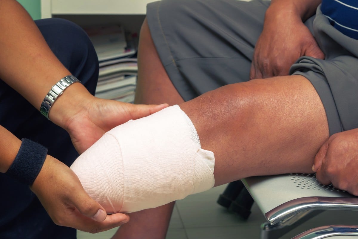 Prosthetics Following Traumatic Amputation - Martin & Helms